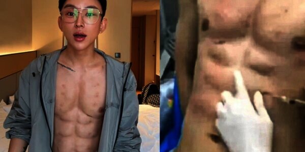 Pria Ini Rela Bayar Rp9,3 Miliar Demi Perut Six Pack Instan | Dream.co.id