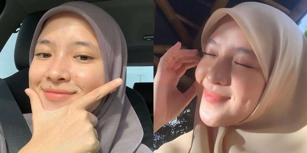 Potret Nissa Sabyan Pamer Close Up Wajah, Warna Matanya Bikin Salfok ...