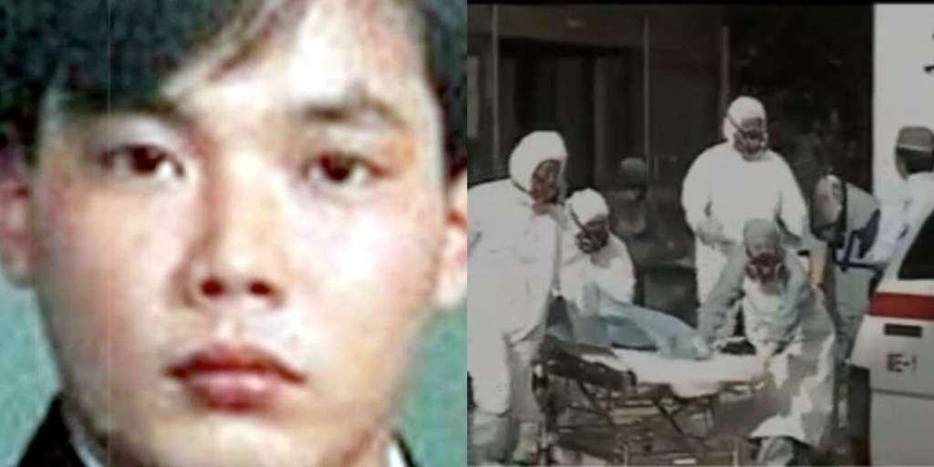 Kondisi Mengerikan Korban Radiasi Nuklir Tinggi: Nangis Darah 83 Hari ...