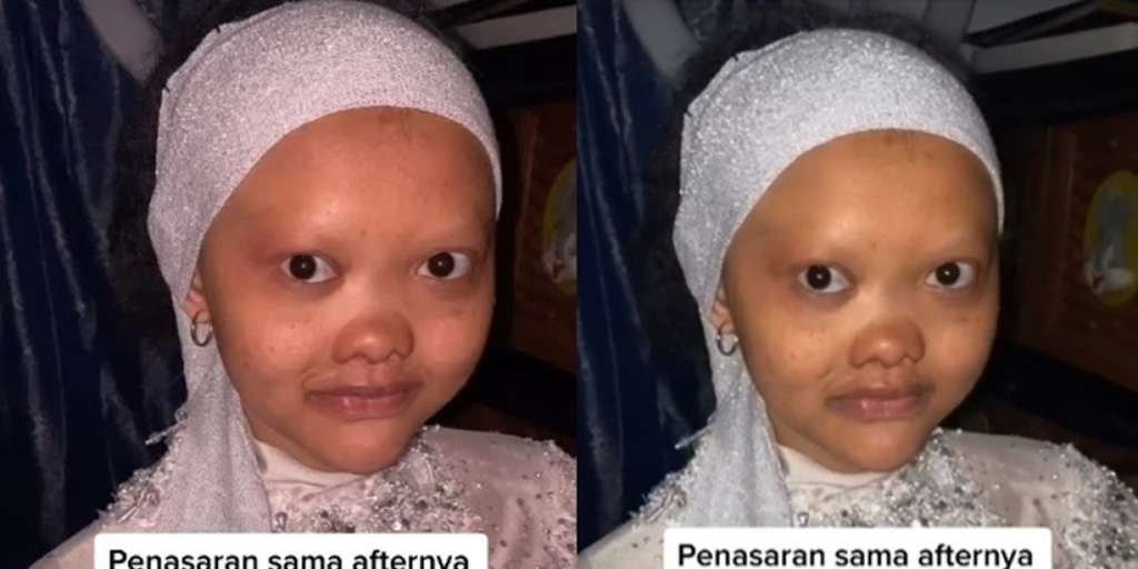 Wanita Spesial Tanpa Alis Dimakeup Jadi Pengantin, Hasilnya Disebut Bak ...